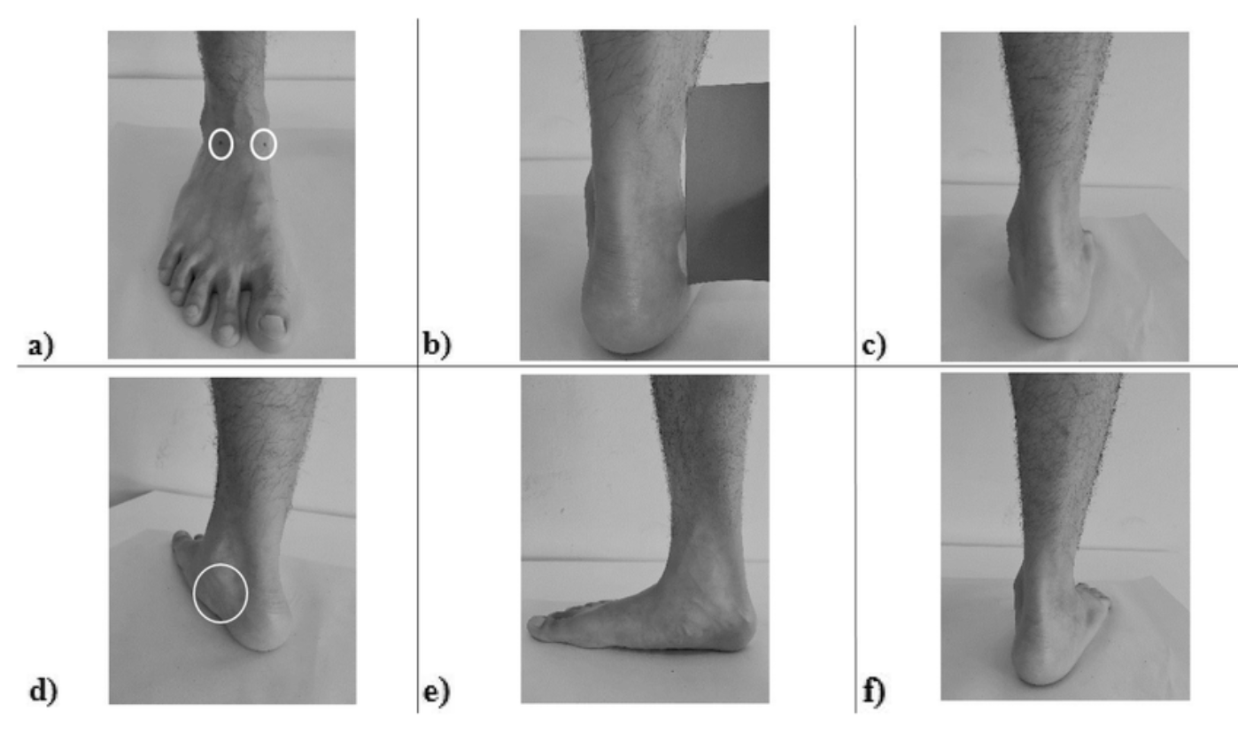 2分でできる足部評価FPI-6(Foot posture index-6)について - Top&Real Academy